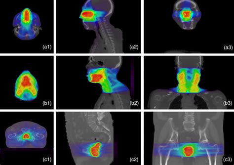 Introduction To Ultra Fast Monte Carlo Dose Calculation Computational Visua Tek