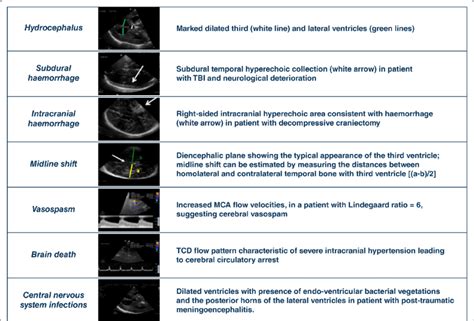 Clinical Applications Of Brain Ultrasonography In Neurocritical Care