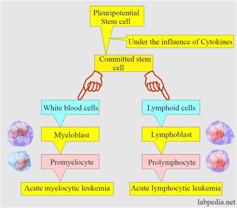 Concept Of Acute Myeloid Leukemia Aml Fab Classificat