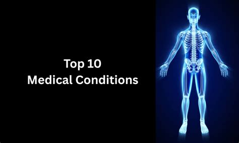 Dmsa Scan Purpose Procedure And What To Expect