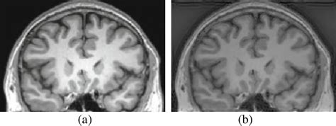 Figure 1 From A Localized Hybrid Penalization Method For Simultaneous