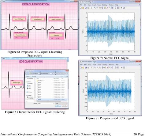 Figure 1 From Clustering The Ecg Signals Using Fuzzy C Means Clustering