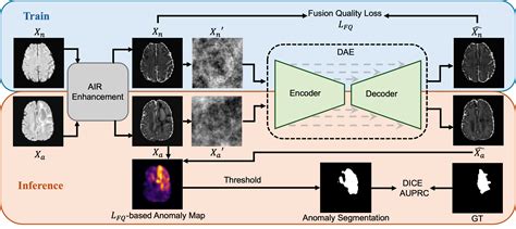Rethinking Medical Anomaly Detection In Brain Mri An Image Quality Assessment Perspective