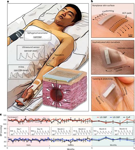 Bertalan Meskó Md Phd On Linkedin Here Is A New Wearable Ultrasound