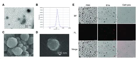 Characterization Of Evs Captured By Fe 3 O 4 Tio 2 A Tem Image Of Download Scientific