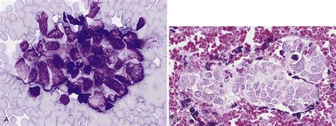 Ovary Basicmedical Key