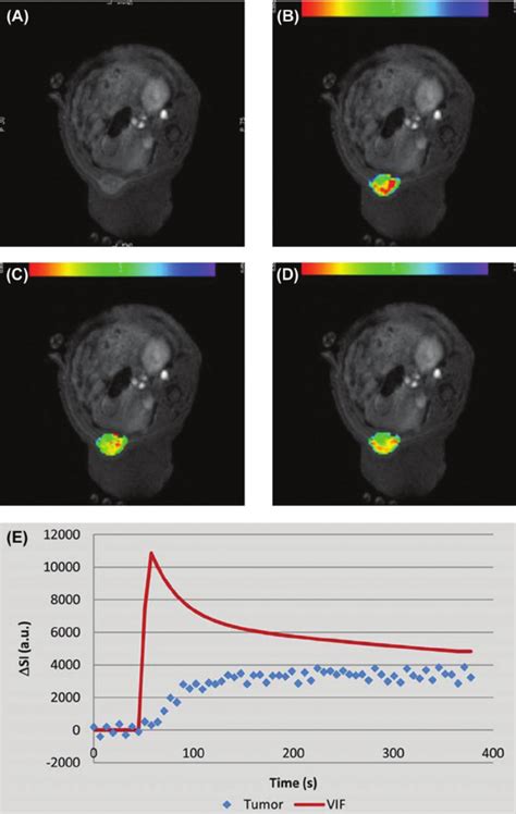 A Axial Dynamic Mri And Dce Mri Parametric Maps For B K Trans Download Scientific