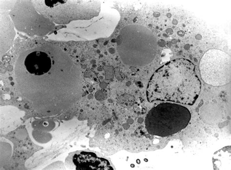 Eritrofagocitosis