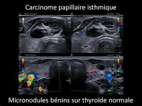 ORL Mougins : Consultation près de Cannes | Radiologie Mougins