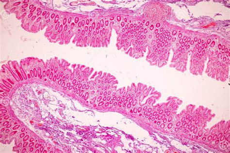 Tissue Of Small Intestine Duodenum Large Intestine Human And Stomach