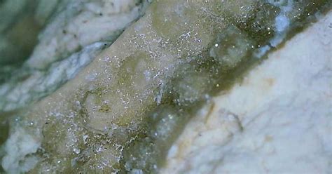 Octorock Microscope Album On Imgur