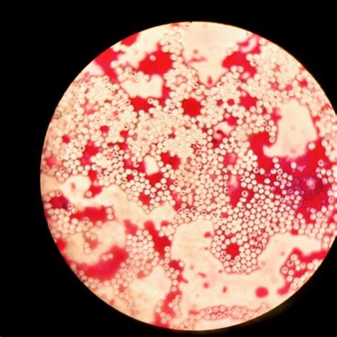Cryptosporidium Spp Oocysts Obtained As A Result Of Enrichment From