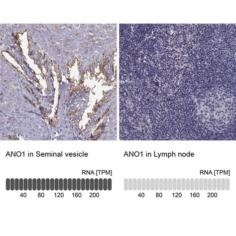 Rabbit Polyclonal Anti Ano1 Antibody Buy For Research Highly