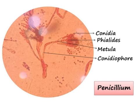 Penicillium Slide Labeled
