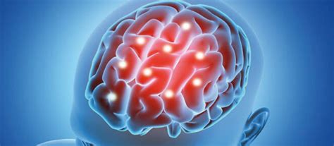 Encefalitis Autoinmune Incluida La Paraneoplásica Cuidados Intensivos