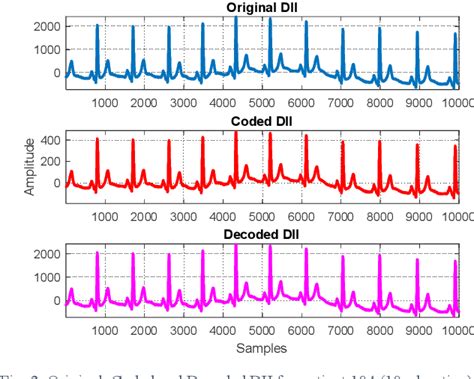 Figure 1 From Lossless Compression Technique For Ecg Signals Using A