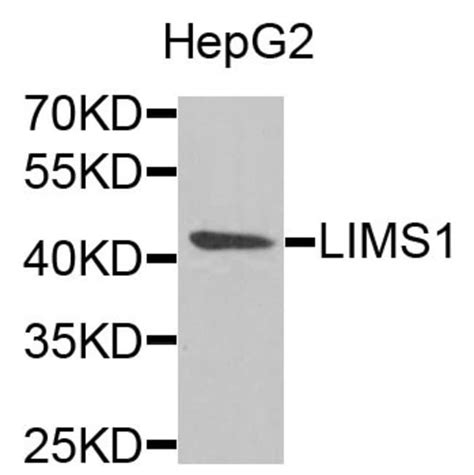 Invitrogen Lims1 Polyclonal Antibody 100 μl Unconjugated Antibodies