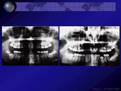 Opi 1 Introduction Tooth Abnormalities Pptx