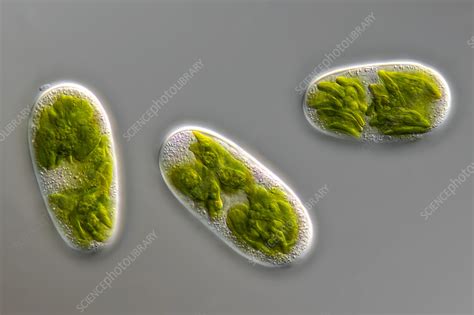 Cylindrocystis Sp Algae Light Micrograph Stock Image C057 0290 Science Photo Library