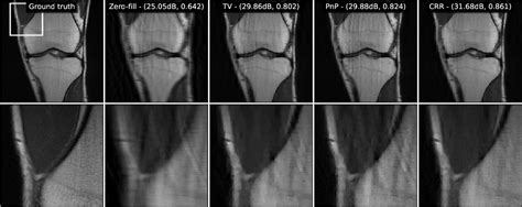 Figure 3 From A Neural Network Based Convex Regularizer For Image Reconstruction Semantic Scholar