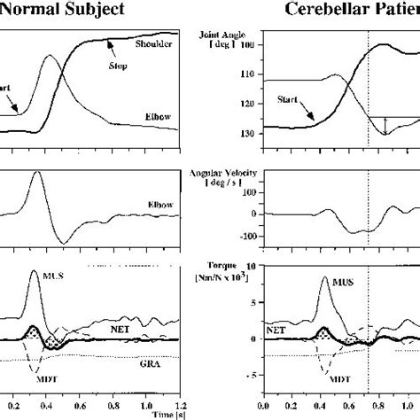 Kinematics And Intersegmental Dynamics Of A Vertical Multijoint