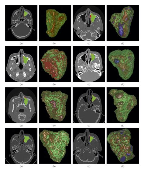 A Selected 2d Slices B 3d Segmentation Results Displayed With