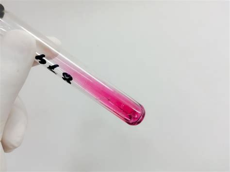 Premium Photo Triple Sugar Iron Tsi Agar For The Detection Bacteria