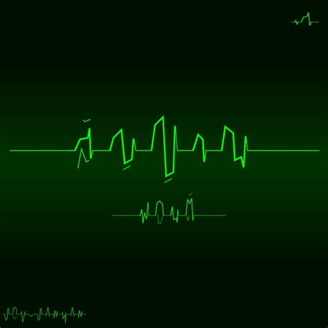 สัญญาณ Sovsanyan ฟอนต์คอม