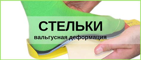 Стельки при вальгусной деформации у взрослых - Stopvalgus