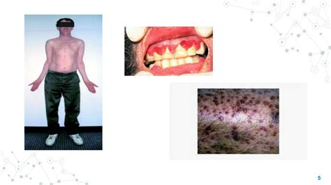 Extracellular Matrix Ppt Pptx