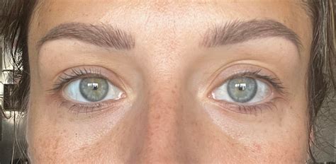 Before And After Germany R Microblading