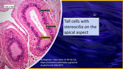 Epididymis Histology Youtube