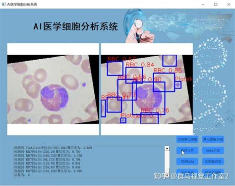 Python基于yolov7的显微镜下细胞识别＆分割系统源码＆部署教程＆数据集 知乎