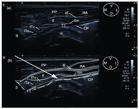 A Anatomical Structures Visualized During The Two Point Download