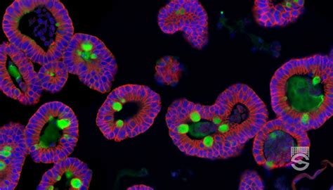 Organoids Ciorba Lab And Research Group Washington University In St
