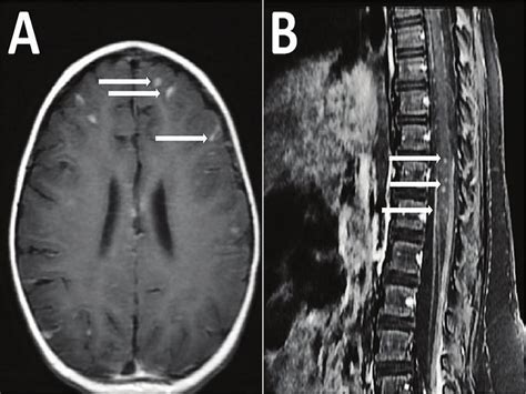 10 Magnetic Resonance Imaging Uses Studiousguy