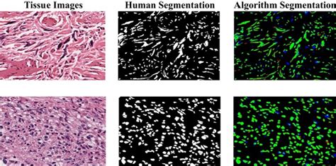 Nuclei Segmentation Input Images Human Segmentation And Algorithm