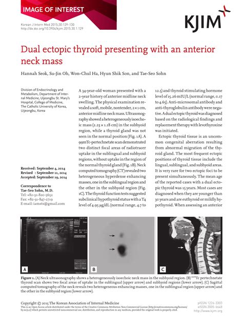 Pdf Dual Ectopic Thyroid Presenting With An Anterior Neck Mass