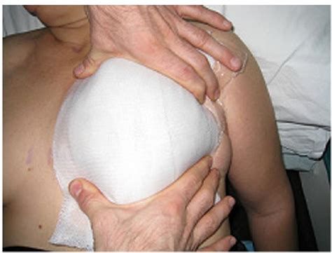 Measurement With Casting Method