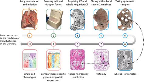 Normal Human Lung Histology