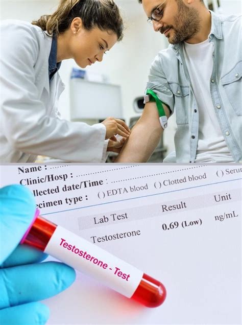 Total Testosterone Vs Free Testosterone Whats The Difference