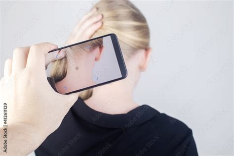 The Woman Shows His Neck With A Chip Implanted Which Is Read Or Scanned By A Special Device