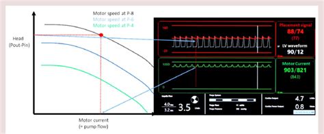 Calculation Of The Left Ventricular Pressure Waveform The Left Panel