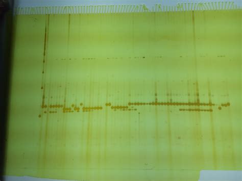 How To Count Allele Polymorphism From The Gel Picture Researchgate