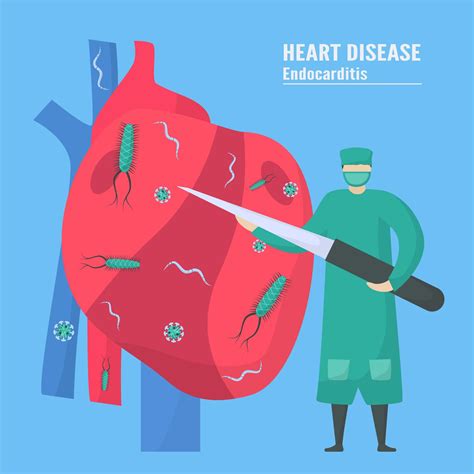 Tratamiento Cardiológico De Endocarditis 965408 Vector En Vecteezy
