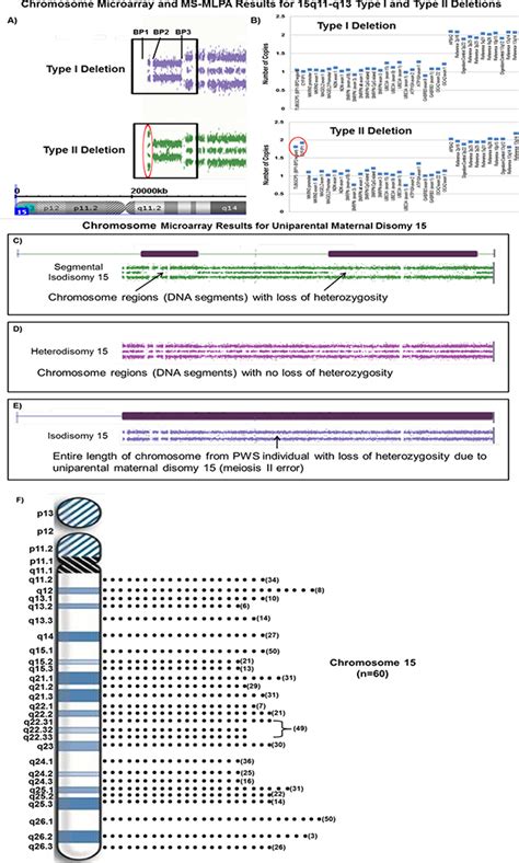 Molecular Genetic Classification In Prader Willi Syndrome A Multisite