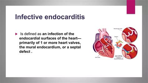 Infective Endocarditis Indications Of Surgery Pptx