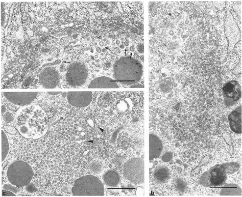 Colchicine Treatment For 6 H A C Demonstrates Different Stages Of The