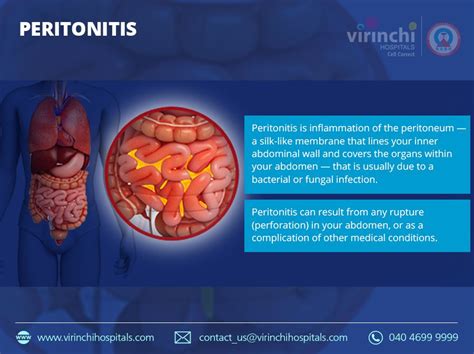 Peritonitis Causes Symptoms Treatment Peritonitis