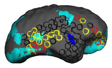 Epilepsy Neural Systems Analysis LaboratoryNeural Systems Analysis Laboratory